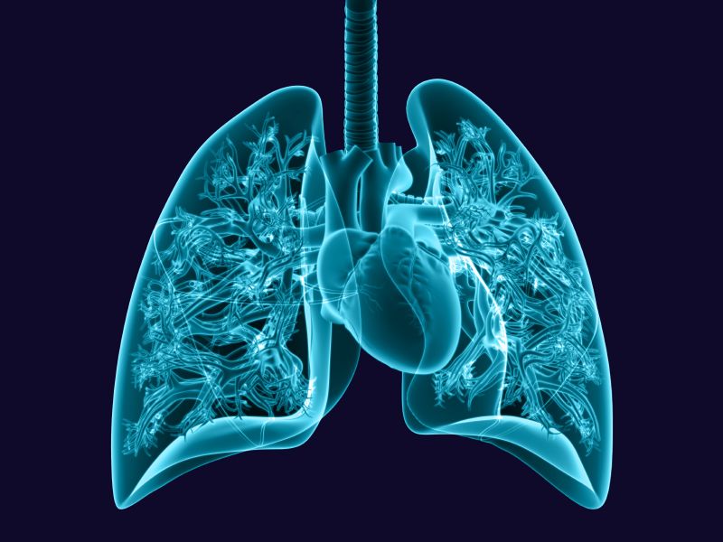 Sagar Rajkuwar on LinkedIn: #pulmonary #pulmonary #pulmonary Sagar Rajkuwar on LinkedIn: #pulmonary #pulmonary #pulmonary
