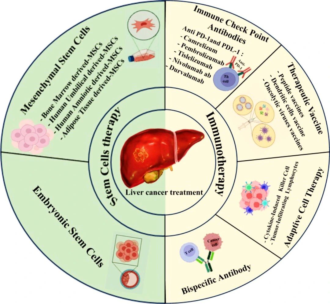 Islam Mamdouh on LinkedIn: #livercancer #hcc #immunotherapy # ... Islam Mamdouh on LinkedIn: #livercancer #hcc #immunotherapy # ...