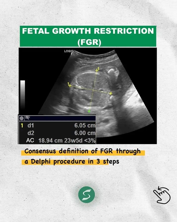#ultrasound #fetalmedicine #fetalultrasound #sonographer… | Shivam Jha #ultrasound #fetalmedicine #fetalultrasound #sonographer… | Shivam Jha