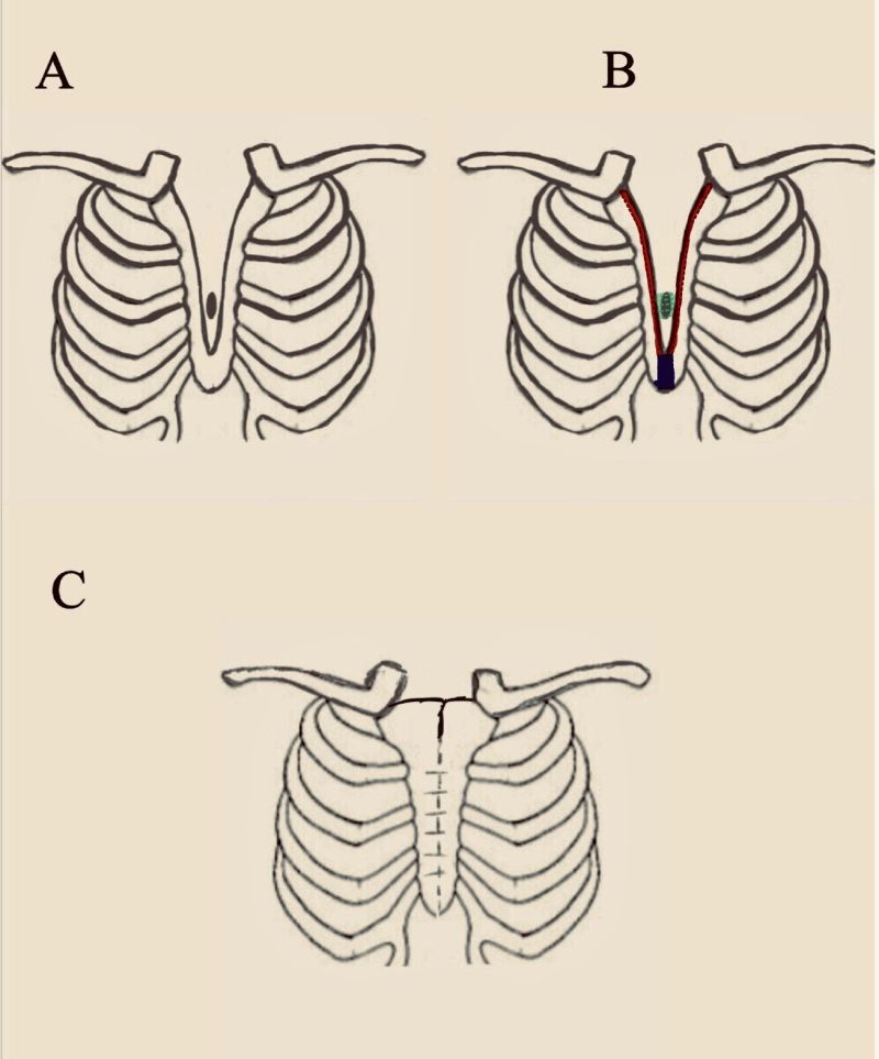 Muhammad Taimour Khan MD on LinkedIn: #medicalillustration # ... Muhammad Taimour Khan MD on LinkedIn: #medicalillustration # ...