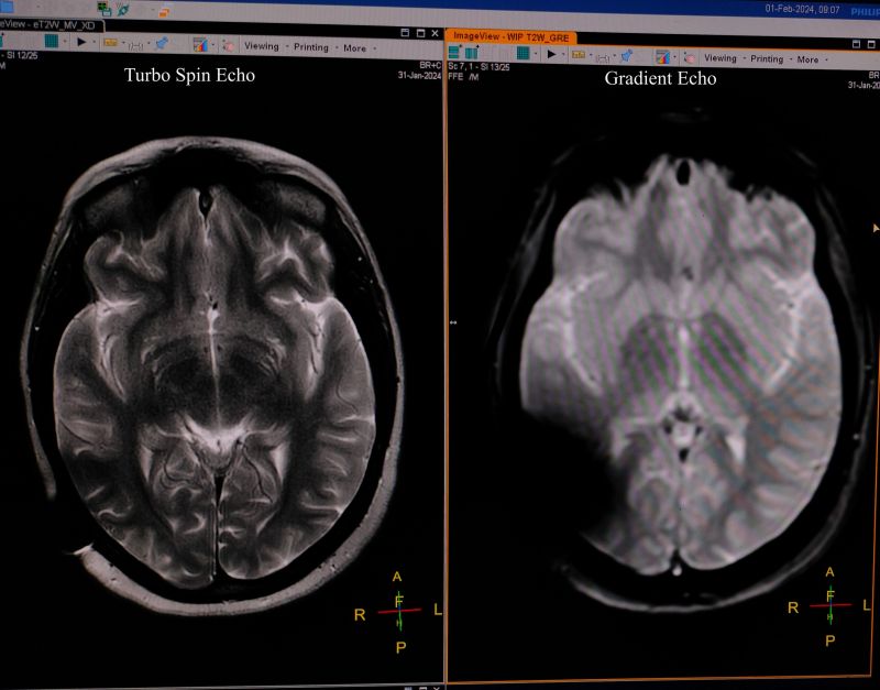 Ritwik Biswas on LinkedIn: #ingenia #tesla #mri #radiology Ritwik Biswas on LinkedIn: #ingenia #tesla #mri #radiology