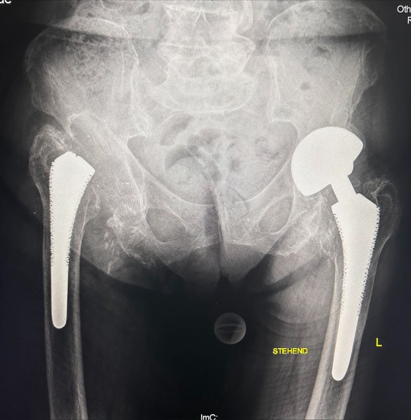Jochen G. Hofstaetter on LinkedIn: #orthopaedics #arthroplasty | 24 ... Jochen G. Hofstaetter on LinkedIn: #orthopaedics #arthroplasty | 24 ...