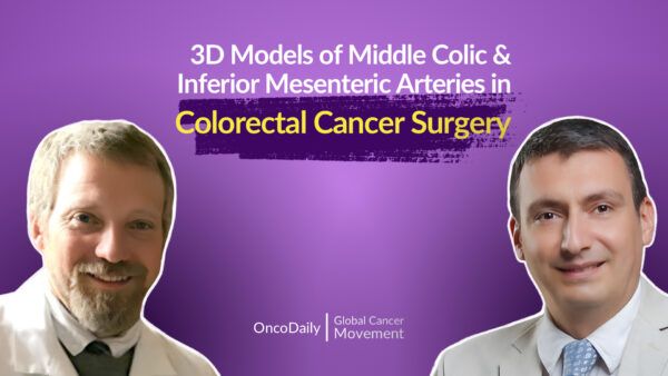 OncoDaily on LinkedIn: #cancer #cancerresearch #colorectalcancer # ... OncoDaily on LinkedIn: #cancer #cancerresearch #colorectalcancer # ...