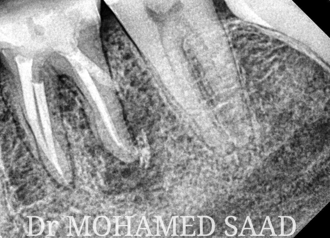 Dr. Mohamad Saad AbdElkhalek PhD on LinkedIn: DME and some RCTs 😀💔 all ... Dr. Mohamad Saad AbdElkhalek PhD on LinkedIn: DME and some RCTs 😀💔 all ...