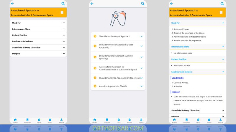 $orthofixar: The Orthopedic Approaches App | Orthofixar | Orthopedic ... $orthofixar: The Orthopedic Approaches App | Orthofixar | Orthopedic ...