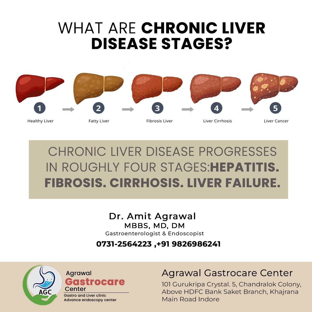 How chronic liver disease affects liver health | Dr. Amit Agrawal ... How chronic liver disease affects liver health | Dr. Amit Agrawal ...