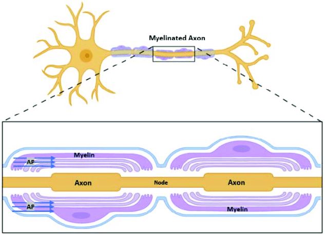 Marwa Gomaa on LinkedIn: Disorders of Peripheral Nerve Lesions of ... Marwa Gomaa on LinkedIn: Disorders of Peripheral Nerve Lesions of ...