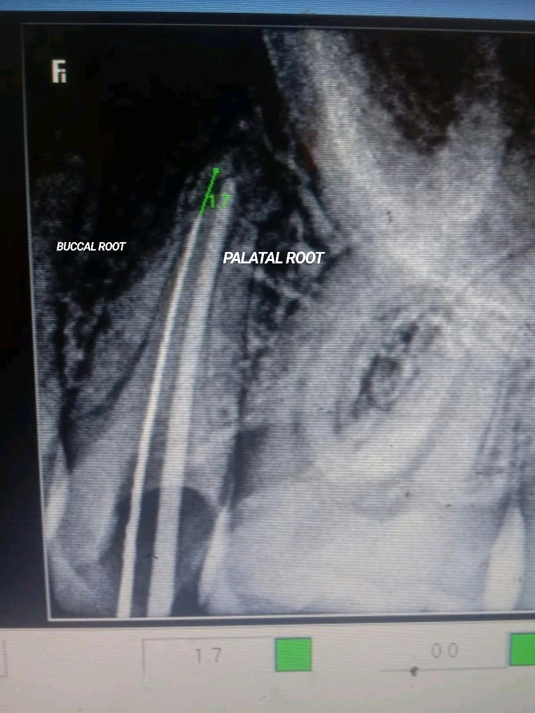 Deepika Soni on LinkedIn: There is nothing like ideal anatomy,wht we ... Deepika Soni on LinkedIn: There is nothing like ideal anatomy,wht we ...