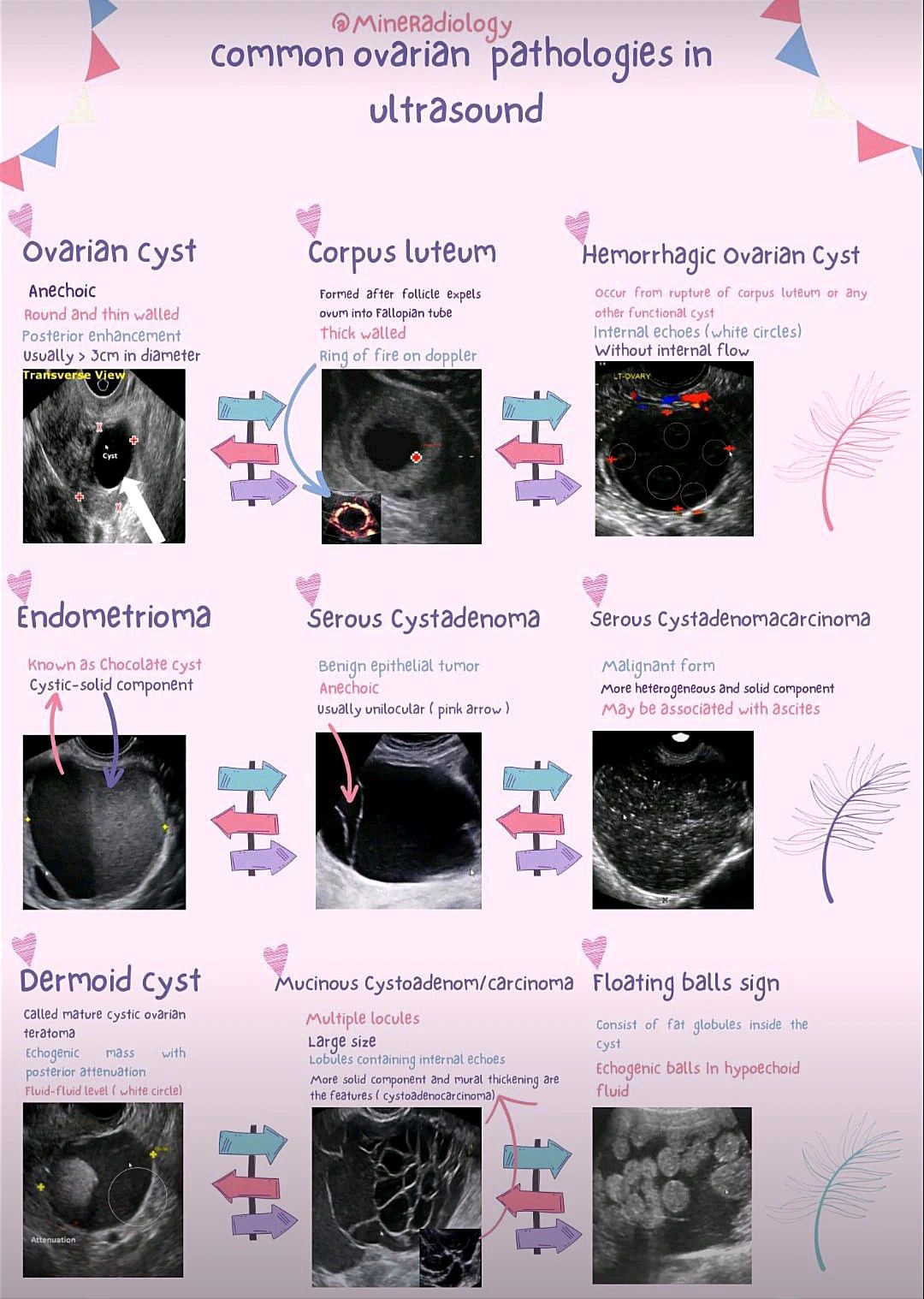 Khawaja Ruman Ahmad on LinkedIn: #radiology #sonography #sonographer # ... Khawaja Ruman Ahmad on LinkedIn: #radiology #sonography #sonographer # ...