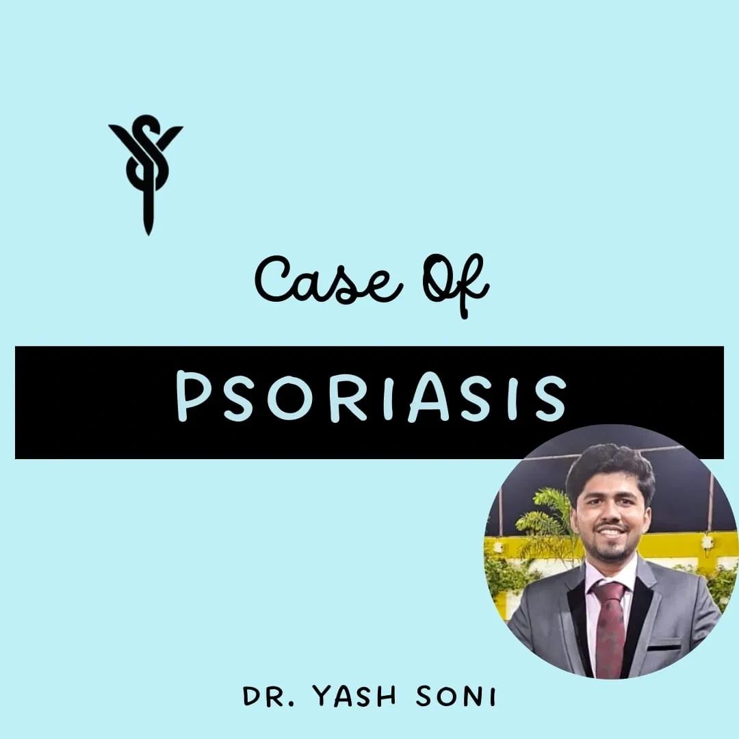 Dr Yash Soni on LinkedIn: #homoeopathy #homeopathy #psoriasis # ... Dr Yash Soni on LinkedIn: #homoeopathy #homeopathy #psoriasis # ...