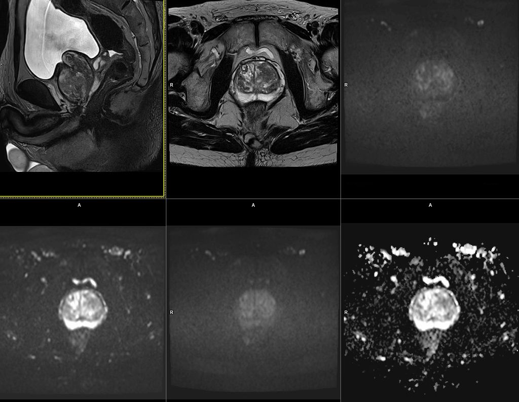 Khawaja Ruman Ahmad on LinkedIn: Prostate Scan Khawaja Ruman Ahmad on LinkedIn: Prostate Scan