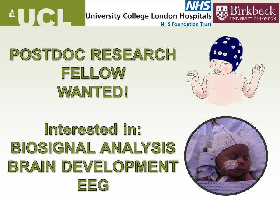 jobRxiv on LinkedIn: Postdoctoral Research Fellow in paediatric brain ... jobRxiv on LinkedIn: Postdoctoral Research Fellow in paediatric brain ...