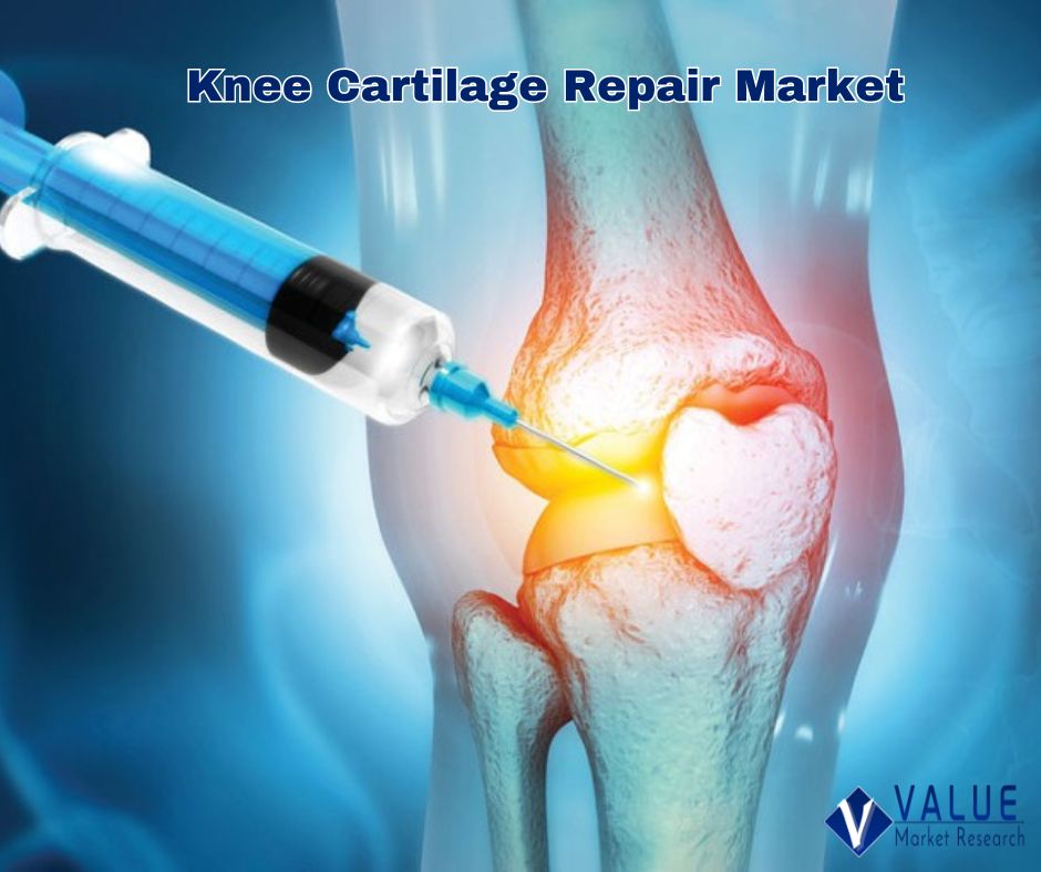 Ankur Khandelwal on LinkedIn: #knee_cartilage_repair Ankur Khandelwal on LinkedIn: #knee_cartilage_repair