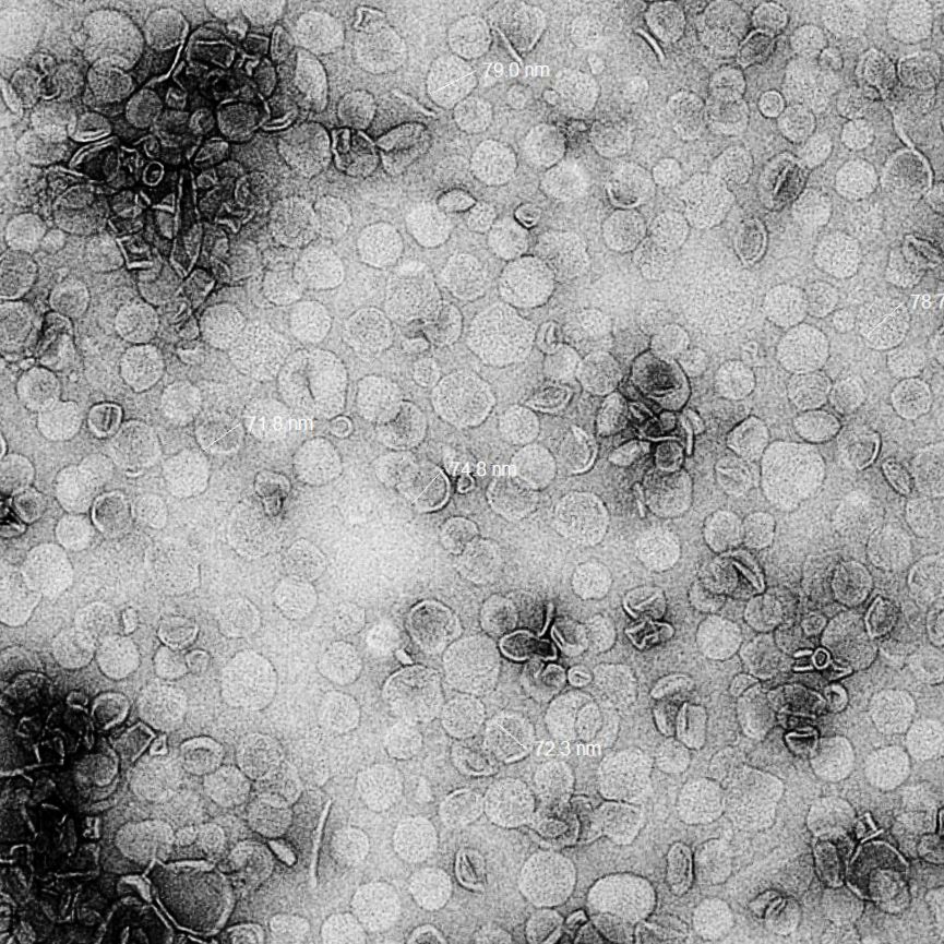 Dr. Vikas Patel on LinkedIn: Amphotericin B Dr. Vikas Patel on LinkedIn: Amphotericin B