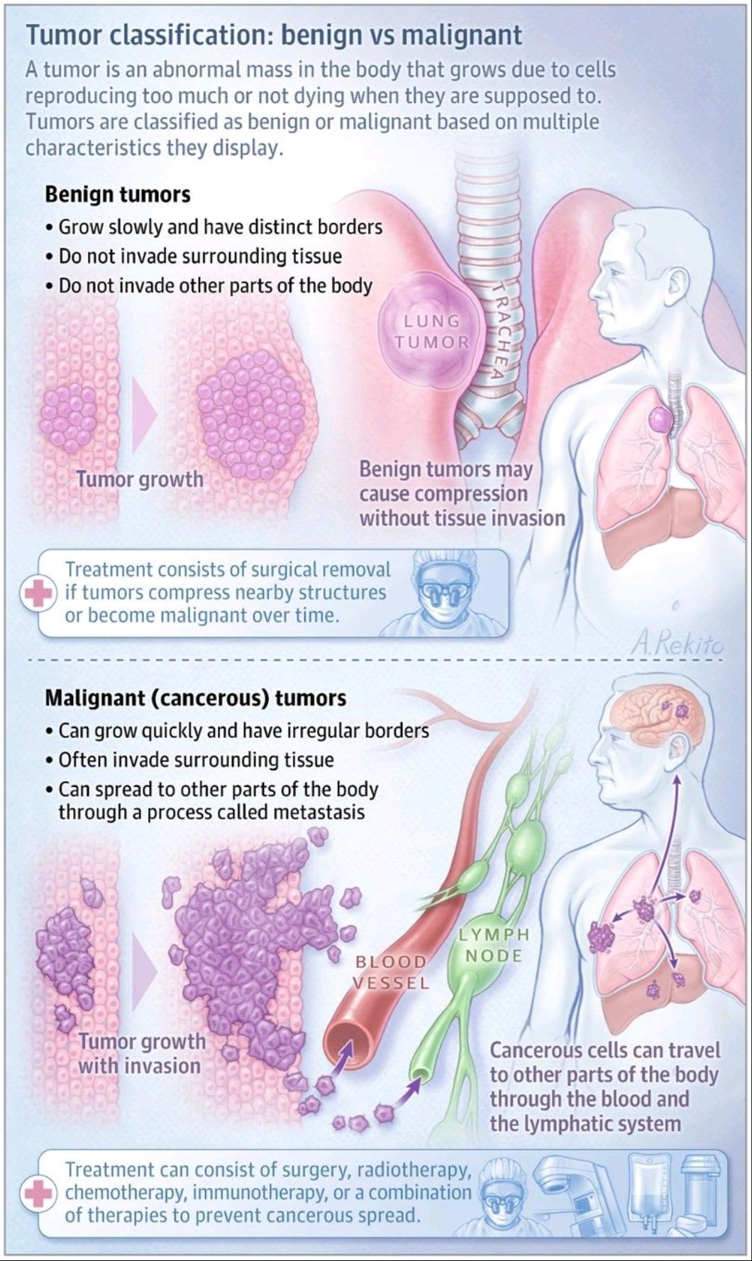 An Easy way to Learn Difference of Benign and Malignant Tumors ... An Easy way to Learn Difference of Benign and Malignant Tumors ...