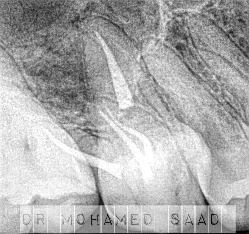 Yo, check out MB2, it's a real beauty. | Dr. Mohamad Saad AbdElkhalek PhD Yo, check out MB2, it's a real beauty. | Dr. Mohamad Saad AbdElkhalek PhD