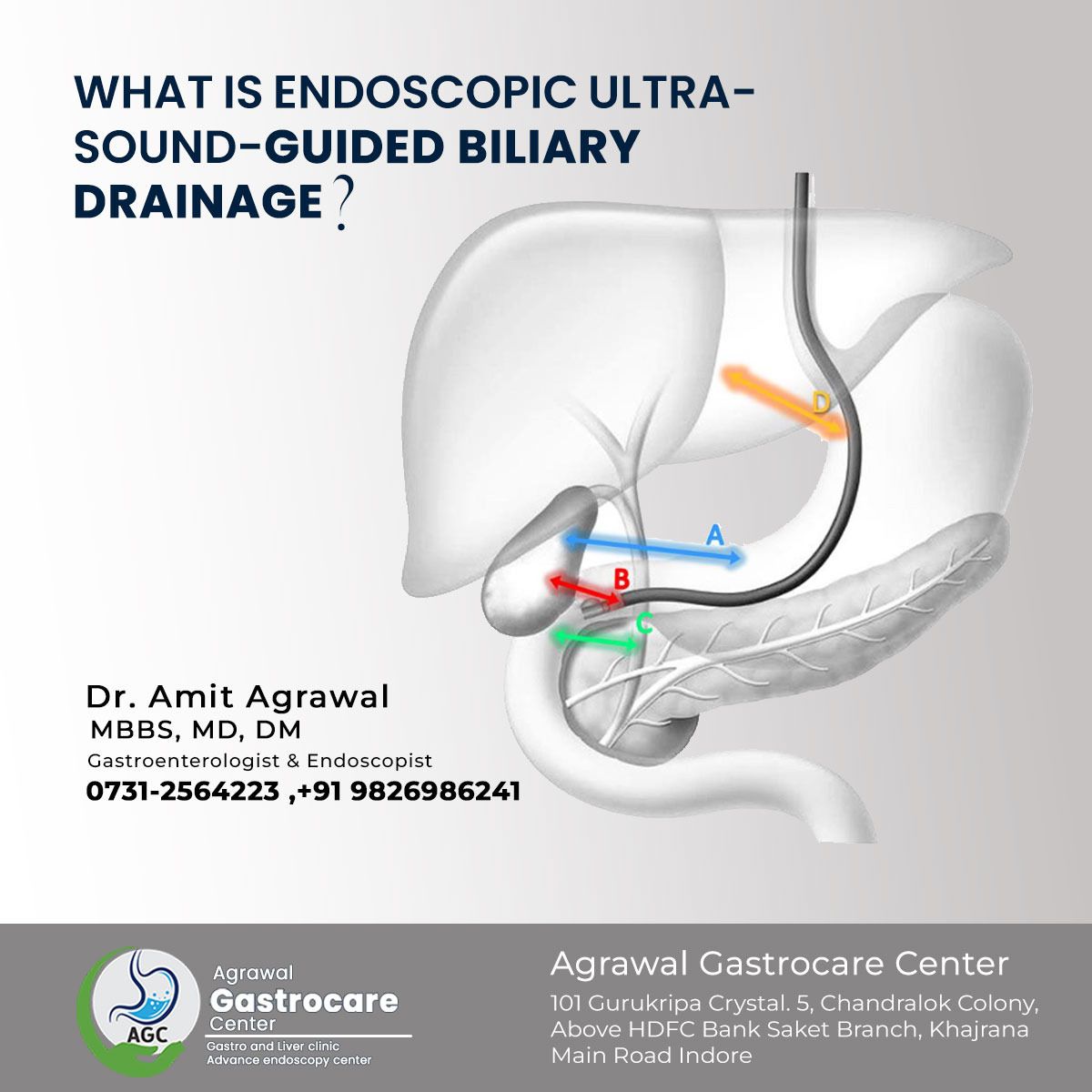 Dr. Amit Agrawal Agrawal Gastrocare Center Indore on LinkedIn: # ... Dr. Amit Agrawal Agrawal Gastrocare Center Indore on LinkedIn: # ...