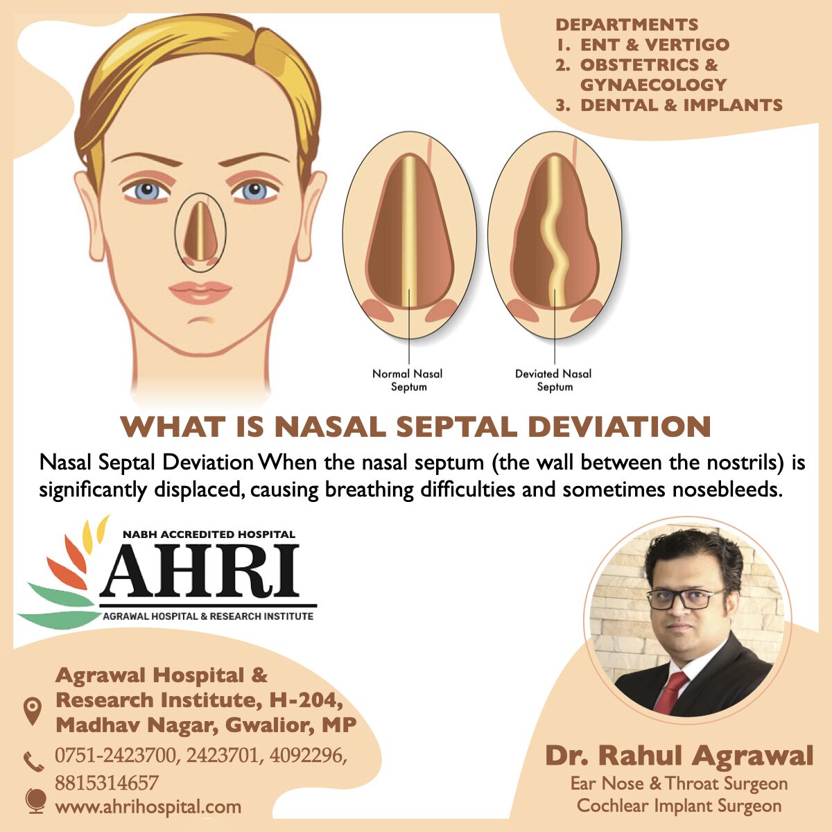 Agrawal Hospital and Research Institute on LinkedIn: What Is Nasal ... Agrawal Hospital and Research Institute on LinkedIn: What Is Nasal ...