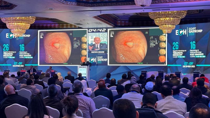 Kareem Mowafy , MBA on LinkedIn: #fujifilm #cadeye #scaleeye #neverstop ... Kareem Mowafy , MBA on LinkedIn: #fujifilm #cadeye #scaleeye #neverstop ...