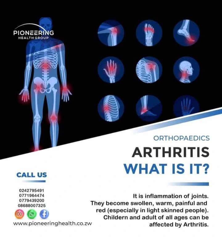 #what #pioneeringhealthgroup | Pioneering Health Group Zimbabwe #what #pioneeringhealthgroup | Pioneering Health Group Zimbabwe