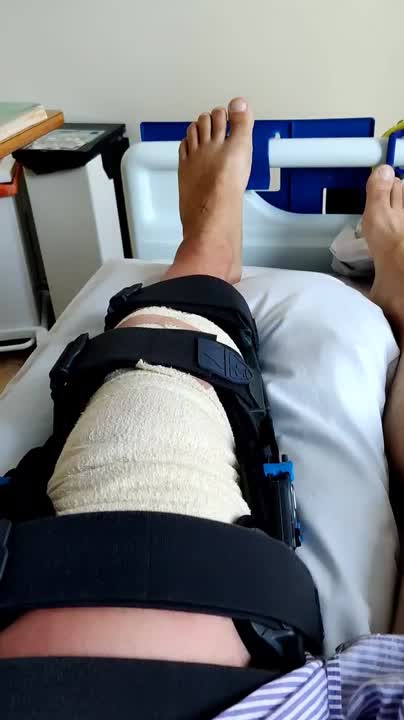 Ricky Du Plessis (MSc.) 🥩 on LinkedIn: Roughly 6-7 hours post-op and ... Ricky Du Plessis (MSc.) 🥩 on LinkedIn: Roughly 6-7 hours post-op and ...