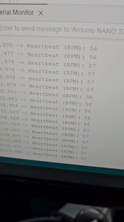 Erik Oostveen on LinkedIn: #pulsebeats #synthdiy #arduino #iot Erik Oostveen on LinkedIn: #pulsebeats #synthdiy #arduino #iot