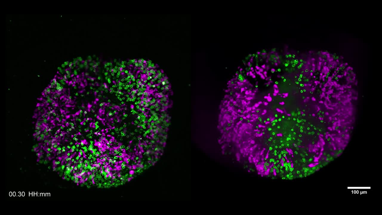Wei Zhu on LinkedIn: Developing brain organoids Wei Zhu on LinkedIn: Developing brain organoids