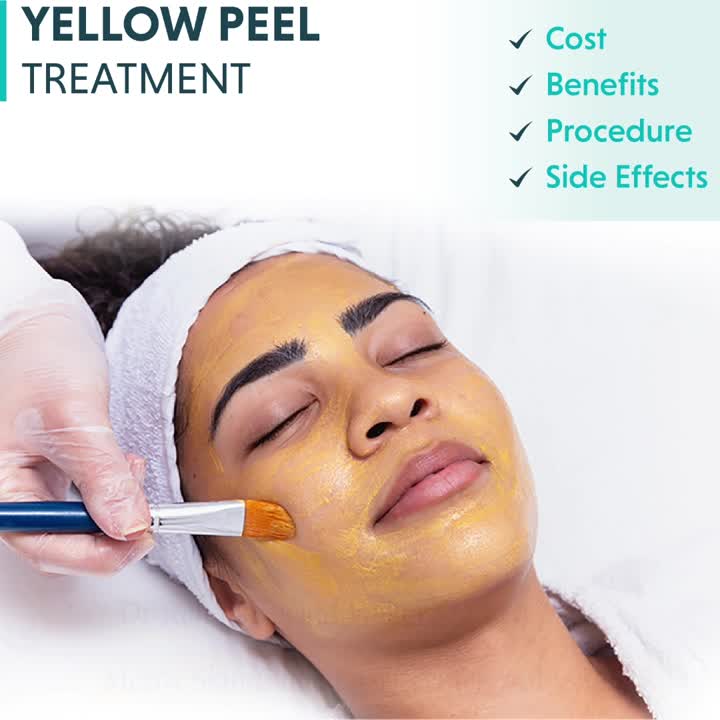 Dr.Rohan Vaikar on LinkedIn: yellow peels for pigmented skin Dr.Rohan Vaikar on LinkedIn: yellow peels for pigmented skin