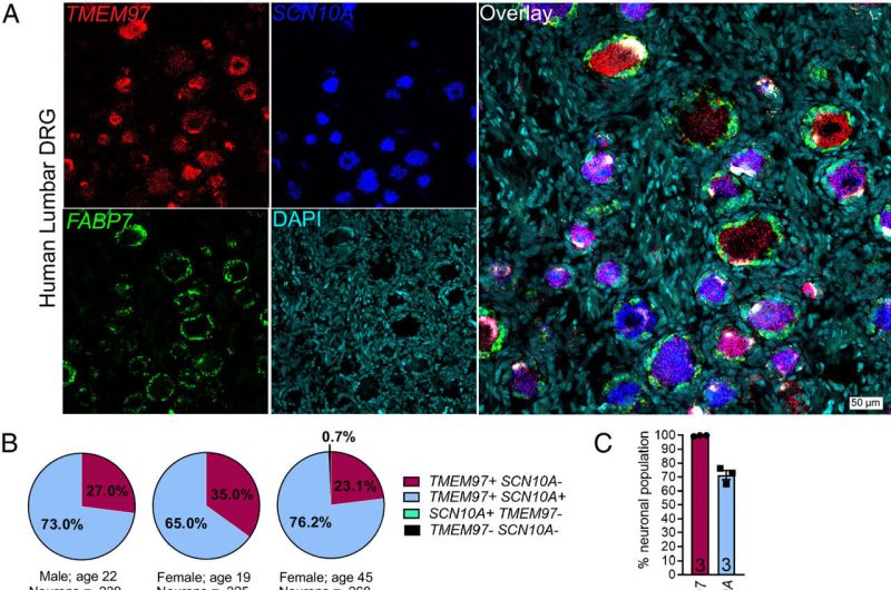 Phys.org on LinkedIn: Researchers uncover potential non-opioid ... Phys.org on LinkedIn: Researchers uncover potential non-opioid ...