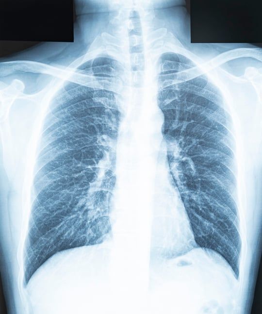 Eric Feuilleaubois (Ph.D) on LinkedIn: Radiologists Outperformed AI in ... Eric Feuilleaubois (Ph.D) on LinkedIn: Radiologists Outperformed AI in ...