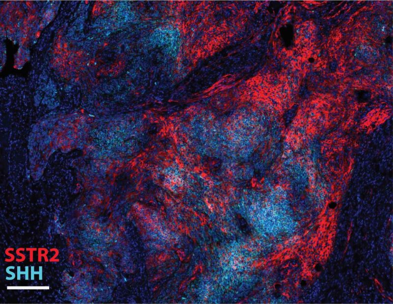 Medical Xpress on LinkedIn: Study identifies genetic cause for some ... Medical Xpress on LinkedIn: Study identifies genetic cause for some ...