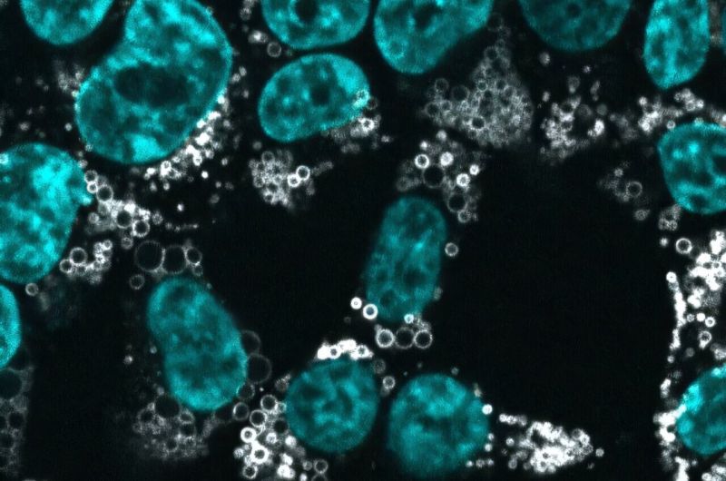 Scientists create comprehensive map of protein locations within human ... Scientists create comprehensive map of protein locations within human ...