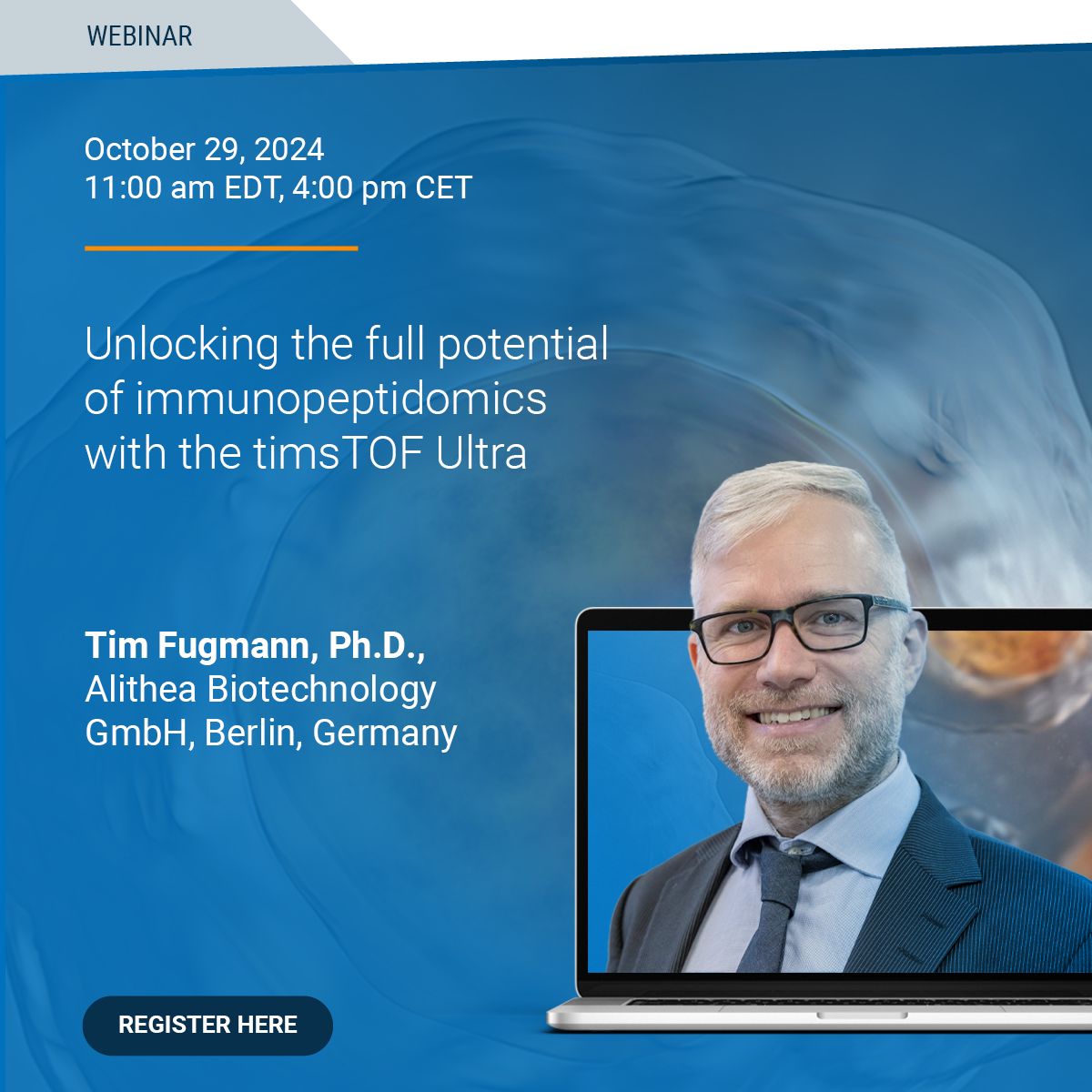 Bruker Daltonics on LinkedIn: #timstofultra #bruker #berlin # ... Bruker Daltonics on LinkedIn: #timstofultra #bruker #berlin # ...