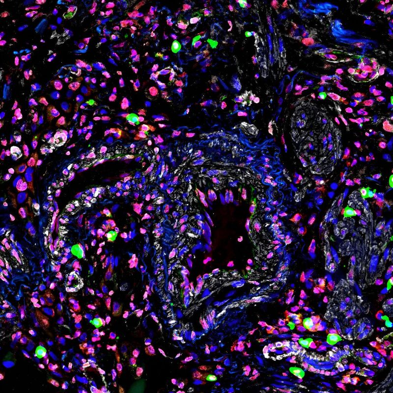 Phys.org on LinkedIn: Genetics may influence the body's response to low ... Phys.org on LinkedIn: Genetics may influence the body's response to low ...