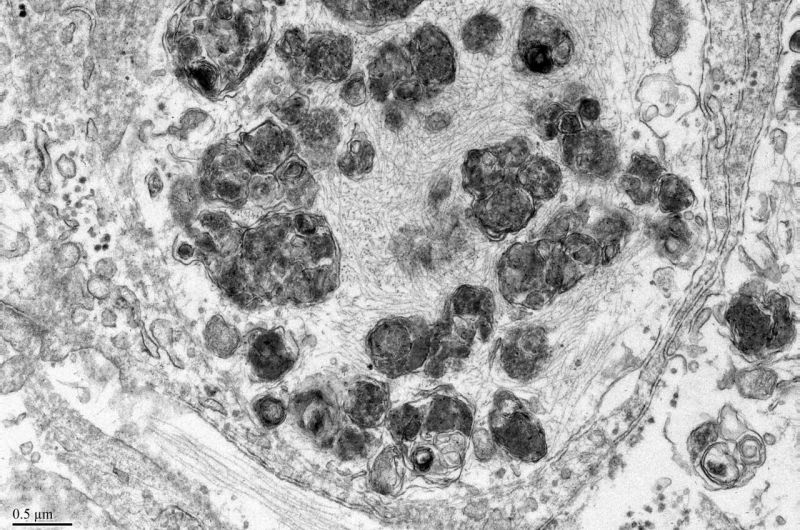 Medical Xpress on LinkedIn: Scientists use stem cells to recreate a ... Medical Xpress on LinkedIn: Scientists use stem cells to recreate a ...
