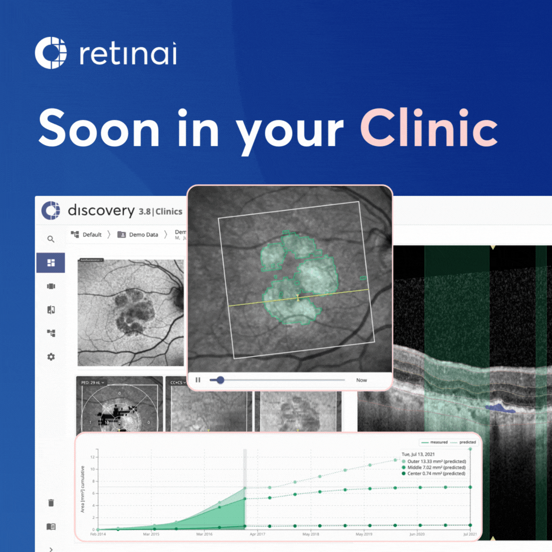 Manage and anticipate Geographic Atrophy like never before with ... Manage and anticipate Geographic Atrophy like never before with ...