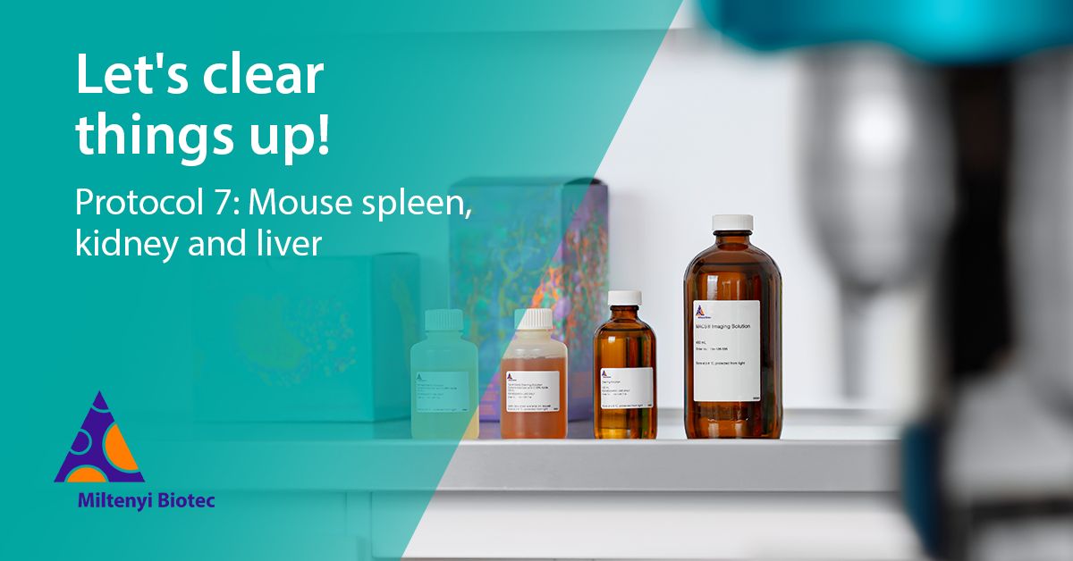 Daniel Legovich on LinkedIn: Immunostaining and clearing of mouse ... Daniel Legovich on LinkedIn: Immunostaining and clearing of mouse ...