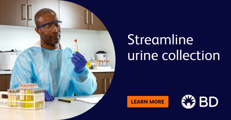 BD Vacutainer ® Urine Collection System | BD BD Vacutainer ® Urine Collection System | BD