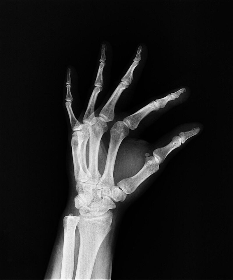 Phys.org on LinkedIn: X-ray vision: Seeing through the mystery of an X ... Phys.org on LinkedIn: X-ray vision: Seeing through the mystery of an X ...
