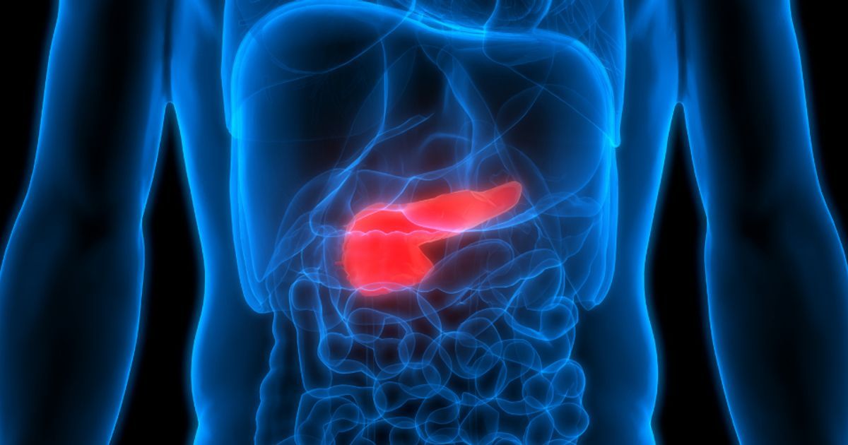 Radiopharm Theranostics doses first patient in Phase 1 pancreatic ... Radiopharm Theranostics doses first patient in Phase 1 pancreatic ...