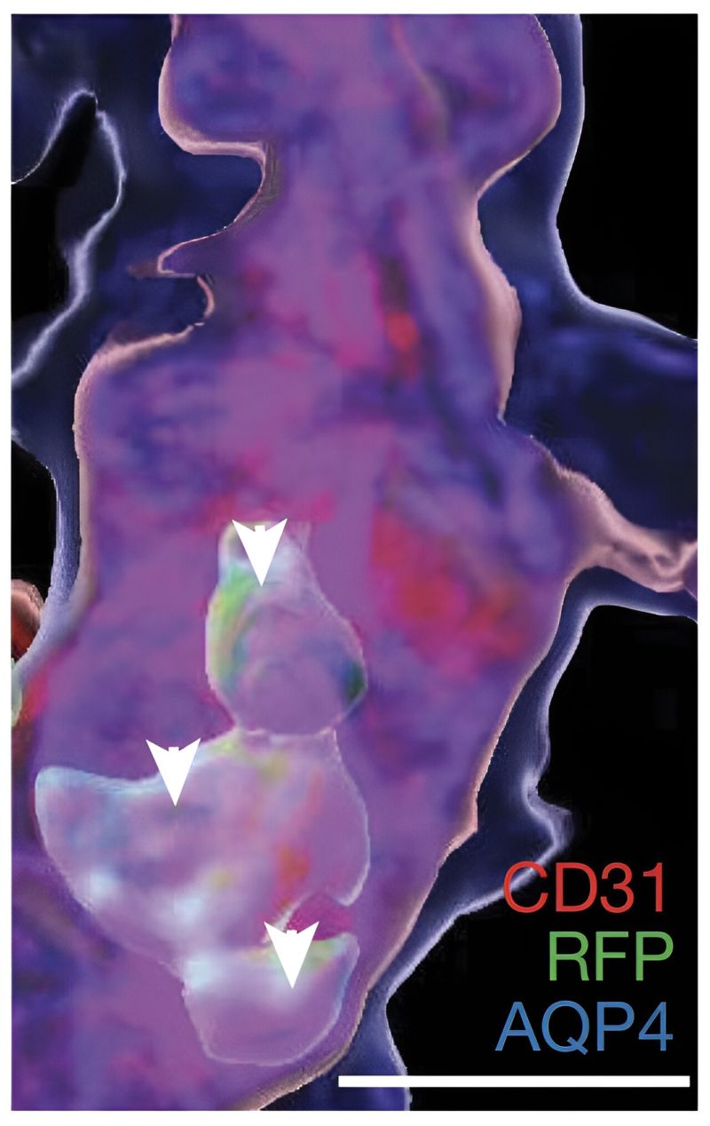 Stress found to influence brain and psyche via immune system | Phys.org Stress found to influence brain and psyche via immune system | Phys.org