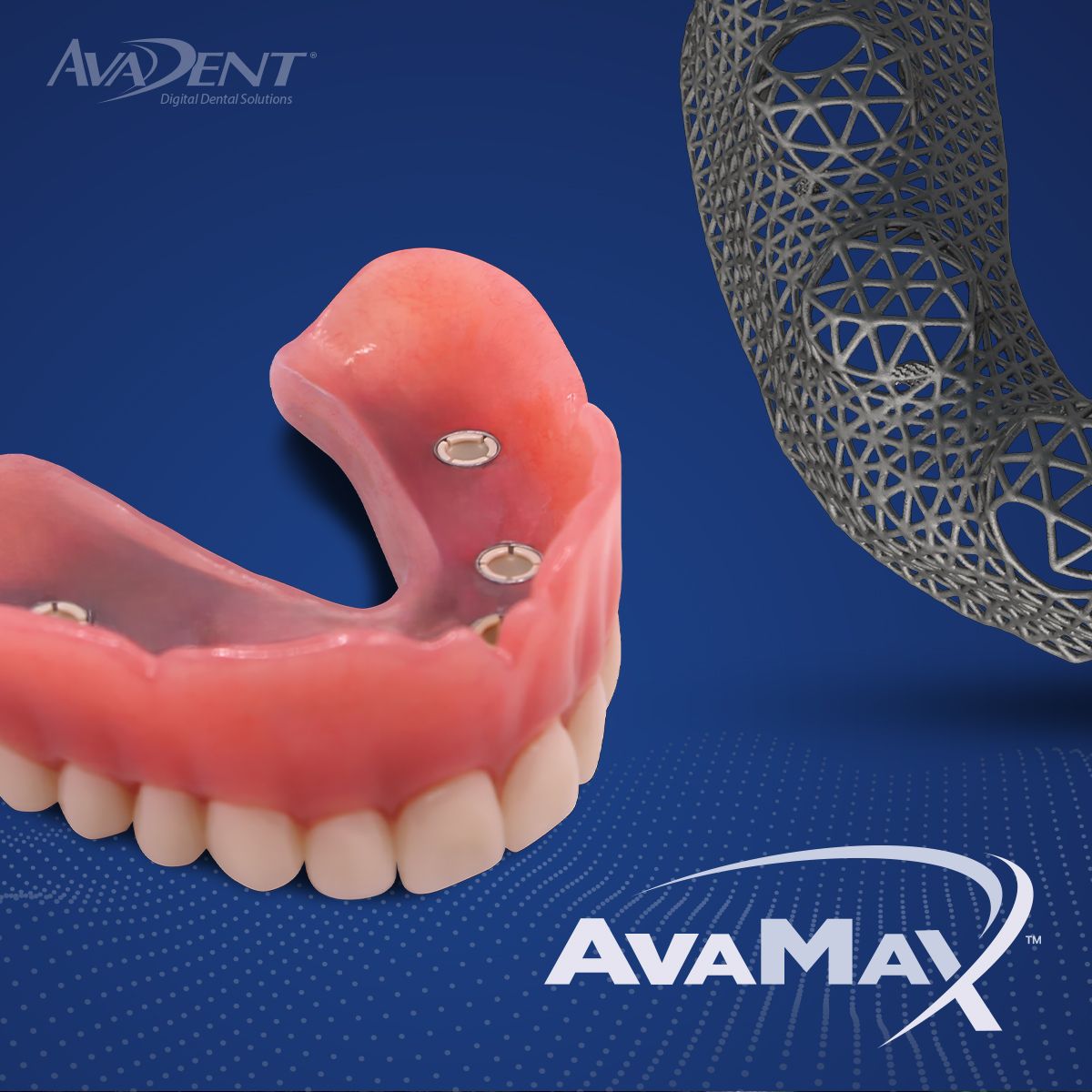 AvaDent by Global Dental Science on LinkedIn: AvaMax - AvaDent Digital ... AvaDent by Global Dental Science on LinkedIn: AvaMax - AvaDent Digital ...