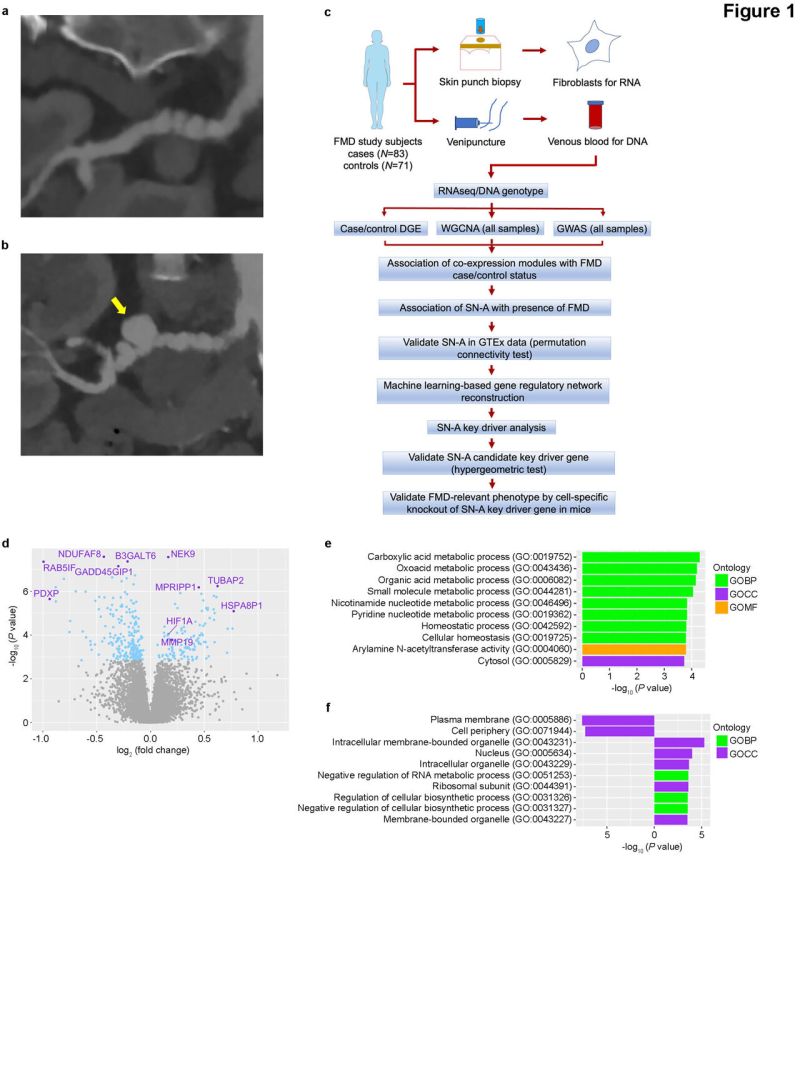 Medical Xpress on LinkedIn: Scientists discover potential cause of an ... Medical Xpress on LinkedIn: Scientists discover potential cause of an ...
