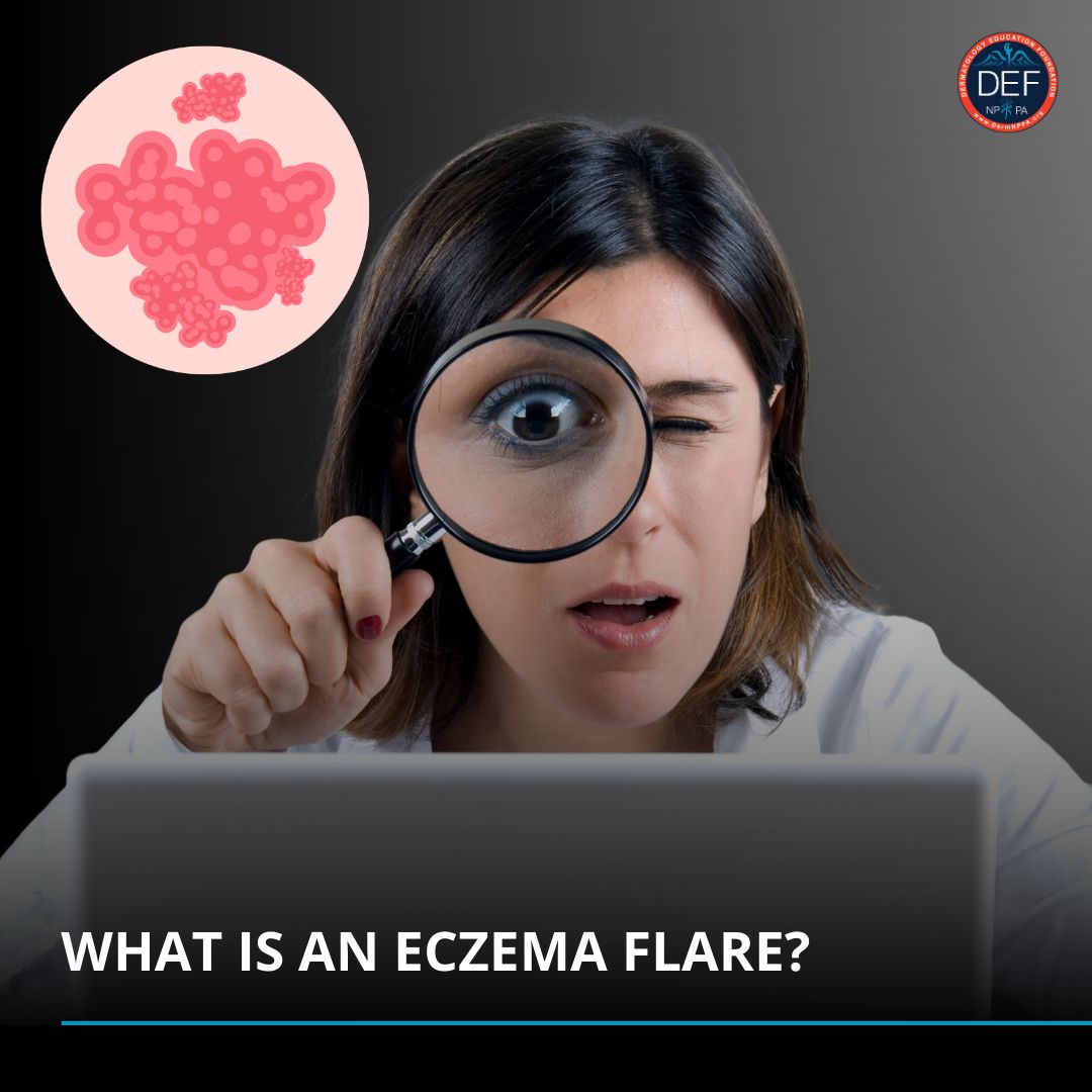 Dermatology Education Foundation on LinkedIn: #eczemaflare #eczema # ... Dermatology Education Foundation on LinkedIn: #eczemaflare #eczema # ...