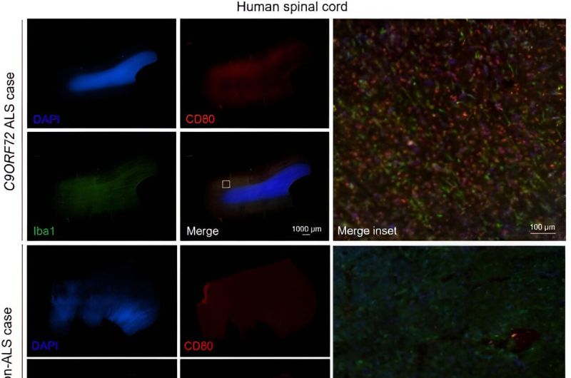 Medical Xpress on LinkedIn: New study identifies gene believed to be ... Medical Xpress on LinkedIn: New study identifies gene believed to be ...