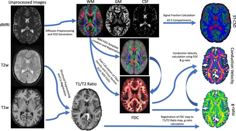 Study identifies new metric for diagnosing autism | Medical Xpress Study identifies new metric for diagnosing autism | Medical Xpress