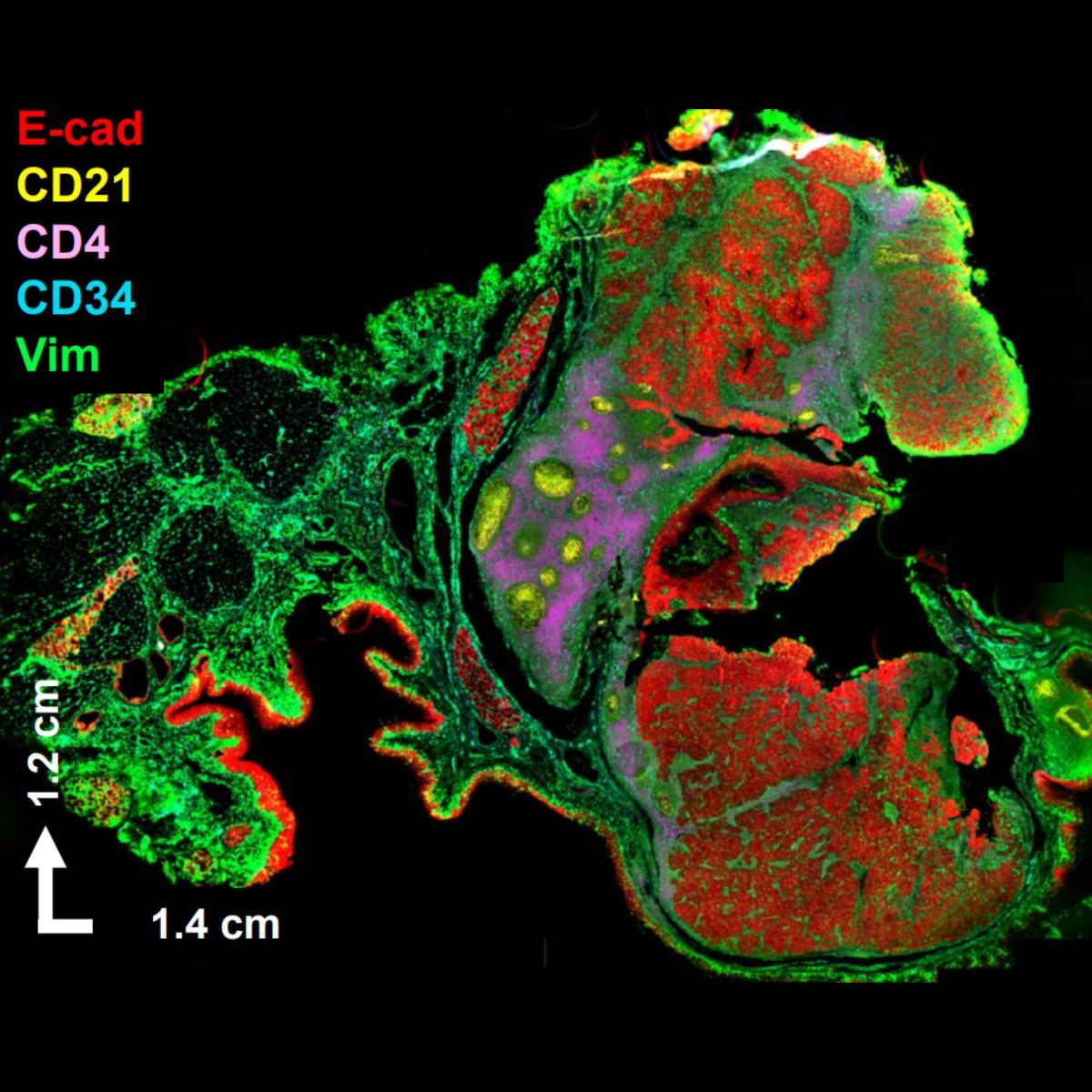 Akoya Biosciences, Inc. on LinkedIn: Single-cell Spatial Metabolic and ... Akoya Biosciences, Inc. on LinkedIn: Single-cell Spatial Metabolic and ...