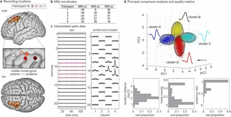 Phys.org on LinkedIn: Study discovers neurons in the human brain that ... Phys.org on LinkedIn: Study discovers neurons in the human brain that ...