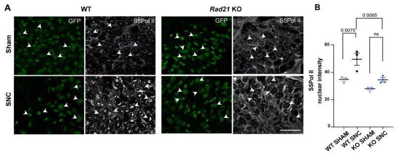 Medical Xpress on LinkedIn: Mouse study explores how nerve cells repair ... Medical Xpress on LinkedIn: Mouse study explores how nerve cells repair ...