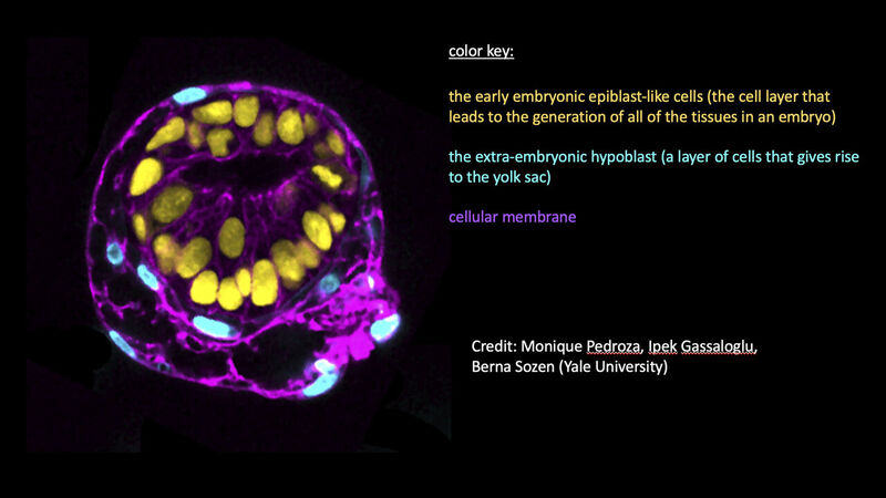 Phys.org on LinkedIn: Scientists use stem cells to create models of ... Phys.org on LinkedIn: Scientists use stem cells to create models of ...